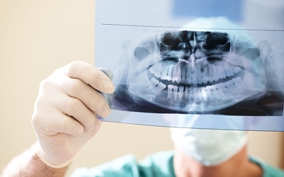 Laser-Assisted Peri-Implantitis Procedure (LAPIP)