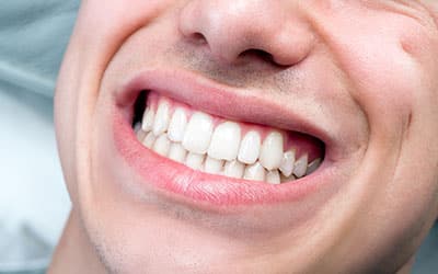 Link Between Shifting Teeth And TMJ - Littleton Implant and Periodontics